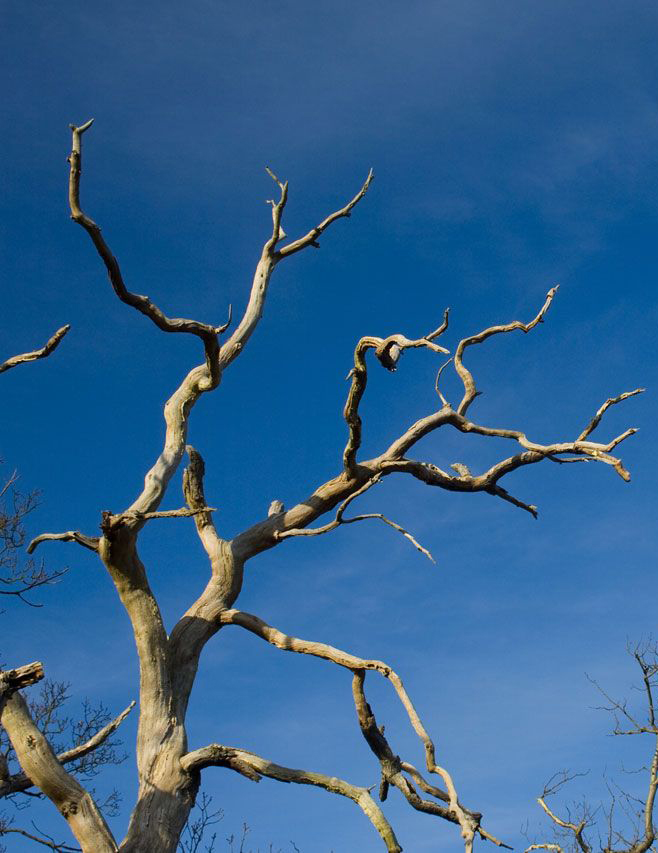 How To Prevent Piano Hand Pain • Best Way Stop Fingers Hurting